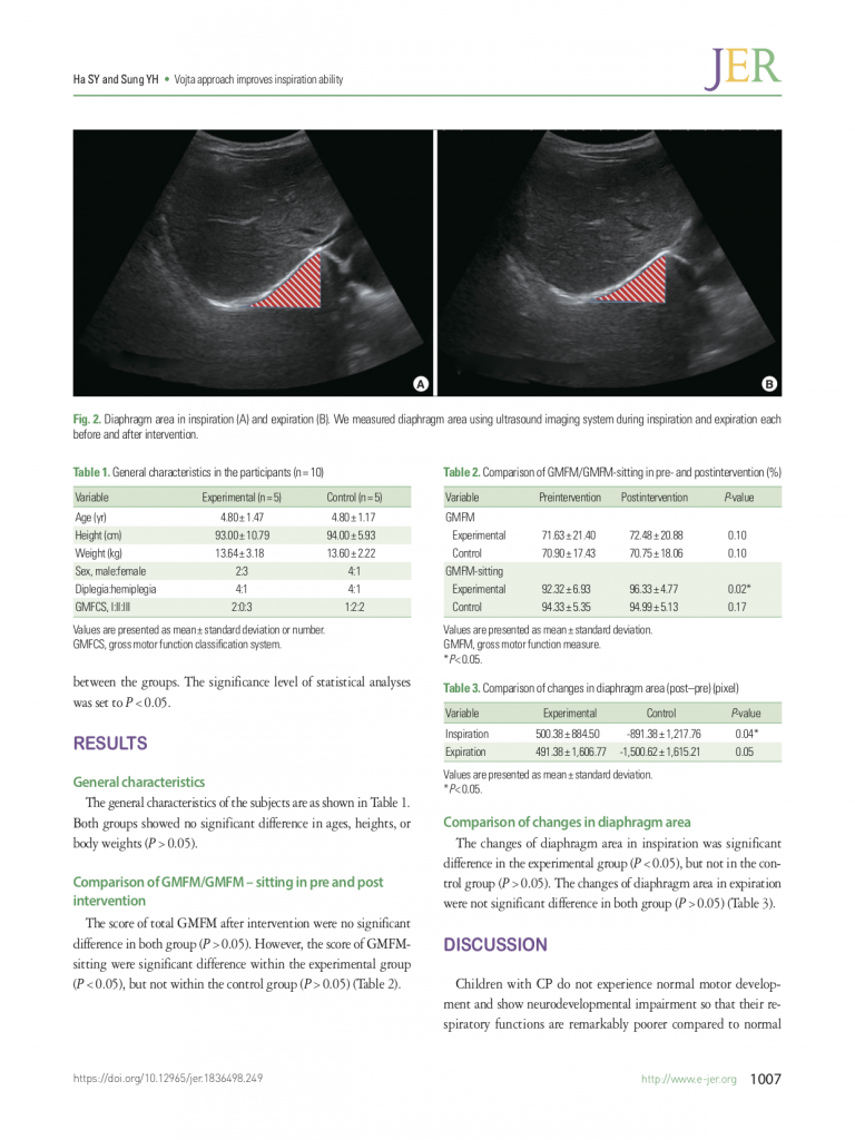 Effects of Vojta approach on diaphragm movement in children with ...